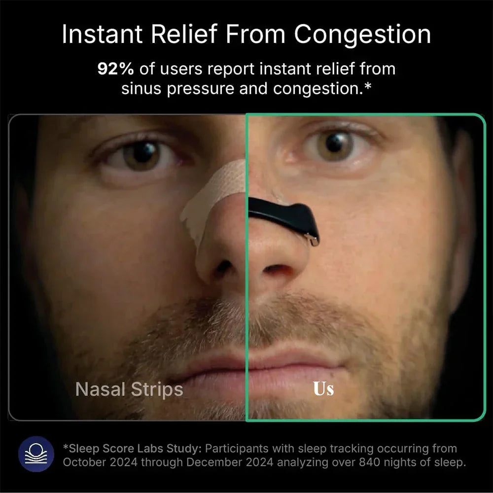 NASOFLOW Nasal Breathing Dilators Starter Kits Anti-snoring Nose Breat ...